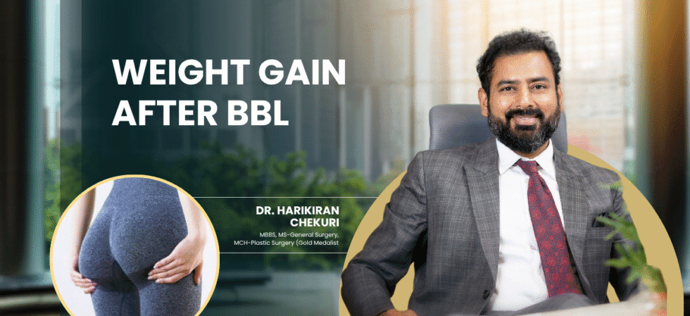 Weight Gain After BBL | Expert Insights